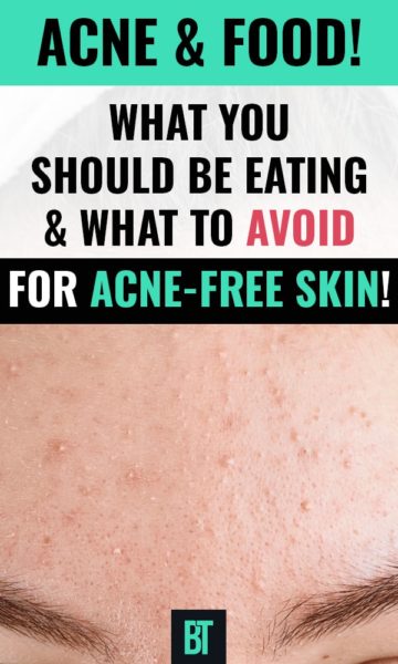 What Foods Cause Acne? Food to Avoid & What You Should Be Eating